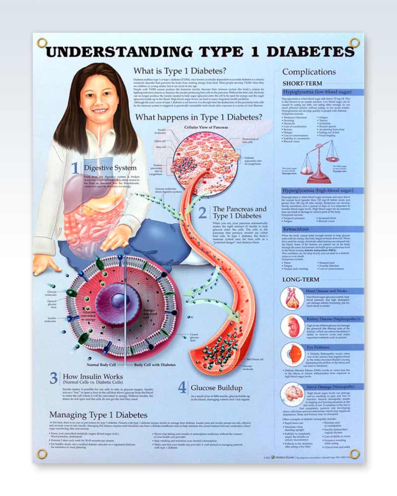 Laminated Type 1 Diabetes Anatomy Posters | ClinicalPosters
