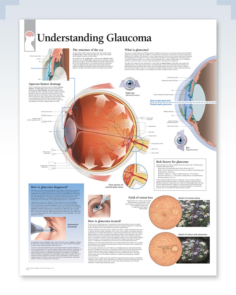 Understanding Glaucoma Exam-Room Anatomy Poster | ClinicalPosters