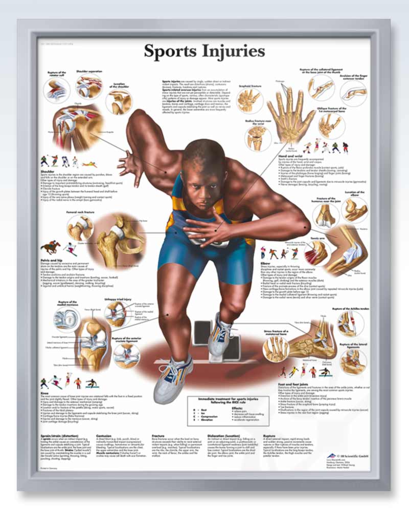 Sports Injuries Exam Room Poster | ClinicalPosters