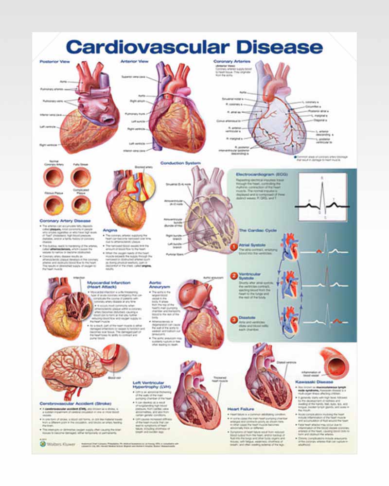 Cardiovascular Disease Exam Room Anatomy Posters | ClinicalPosters