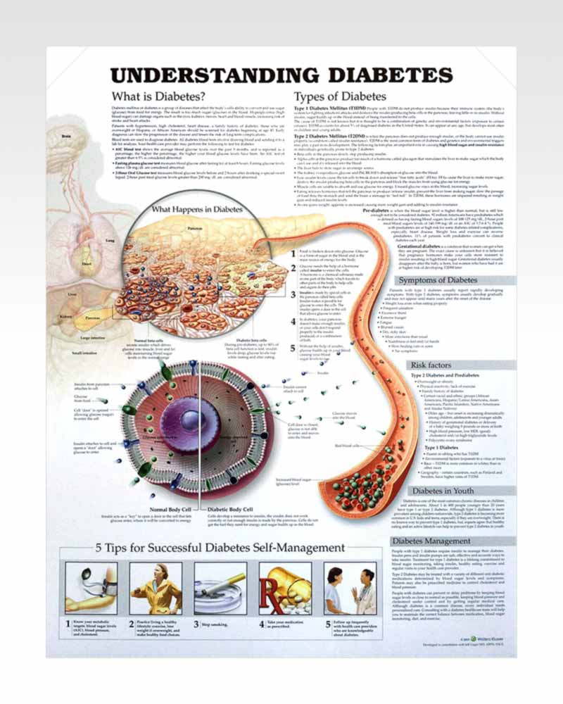 Laminated Diabetes Human Anatomy Posters | ClinicalPosters