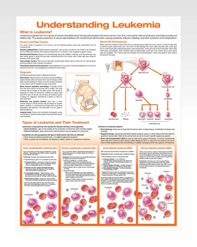 Laminated Leukemia Human Second Edition Poster | ClinicalPosters