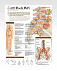 Laminated Low Back Pain Human Anatomy Posters | ClinicalPosters
