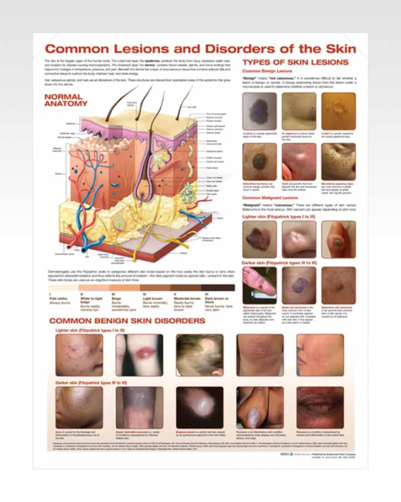 Laminated Common Lesions and Disorders of the Skin | ClinicalPosters