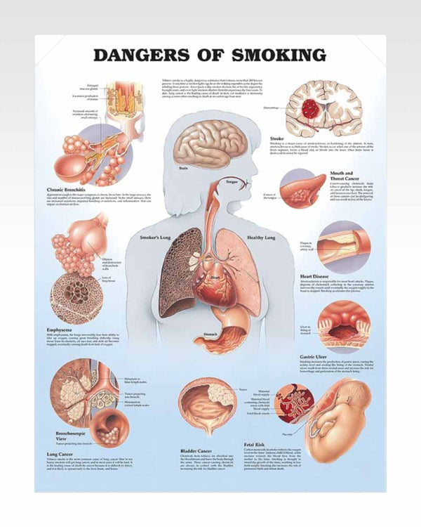 Laminated Dangers of Smoking Anatomy Posters | ClinicalPosters