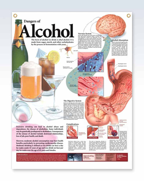 Laminated Dangers of Alcohol Anatomy Poster | ClinicalPosters
