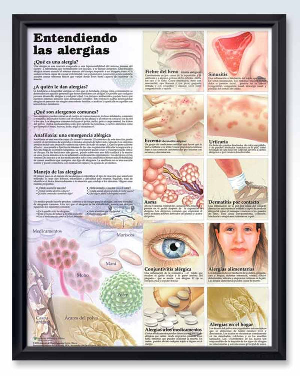 Spanish Medical Anatomy Posters | ClinicalPosters