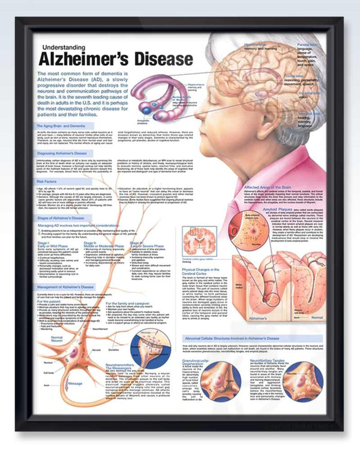 Neurological Medical Anatomy Posters and Models – ClinicalPosters