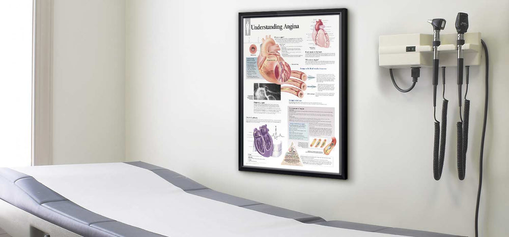 Understanding Angina Exam-Room Anatomy Poster | ClinicalPosters