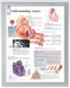 Understanding Angina Exam-Room Anatomy Poster | ClinicalPosters