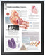 Understanding Angina Exam-Room Anatomy Poster | ClinicalPosters