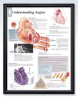 Understanding Angina Exam-Room Anatomy Poster | ClinicalPosters