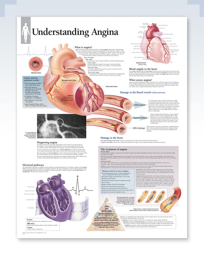 Understanding Angina Exam-Room Anatomy Poster | ClinicalPosters