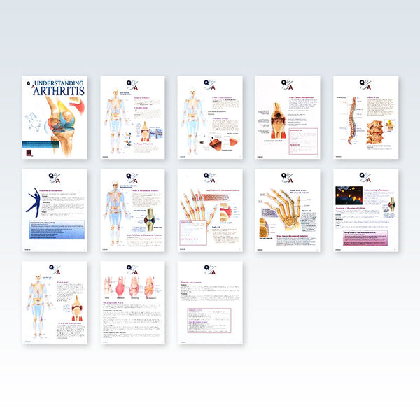 Understanding Arthritis Flip Chart 11x14 | ClinicalPosters