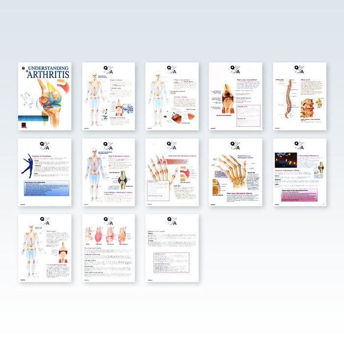 Understanding Arthritis Flip Chart 11x14 | ClinicalPosters