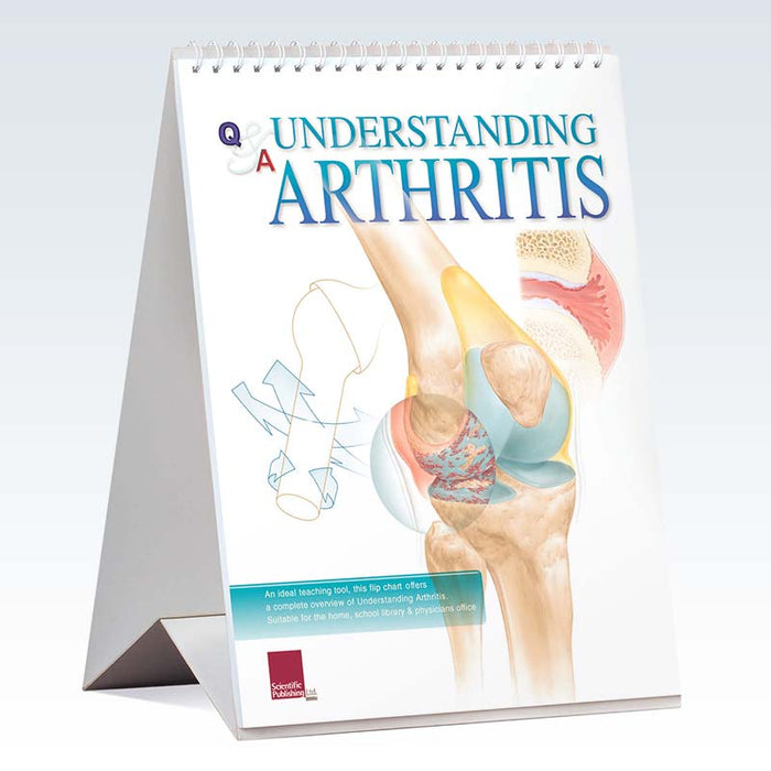 Understanding Arthritis Flip Chart 11x14 | ClinicalPosters