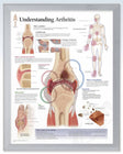 Understanding Arthritis Exam-Room Anatomy Poster | ClinicalPosters
