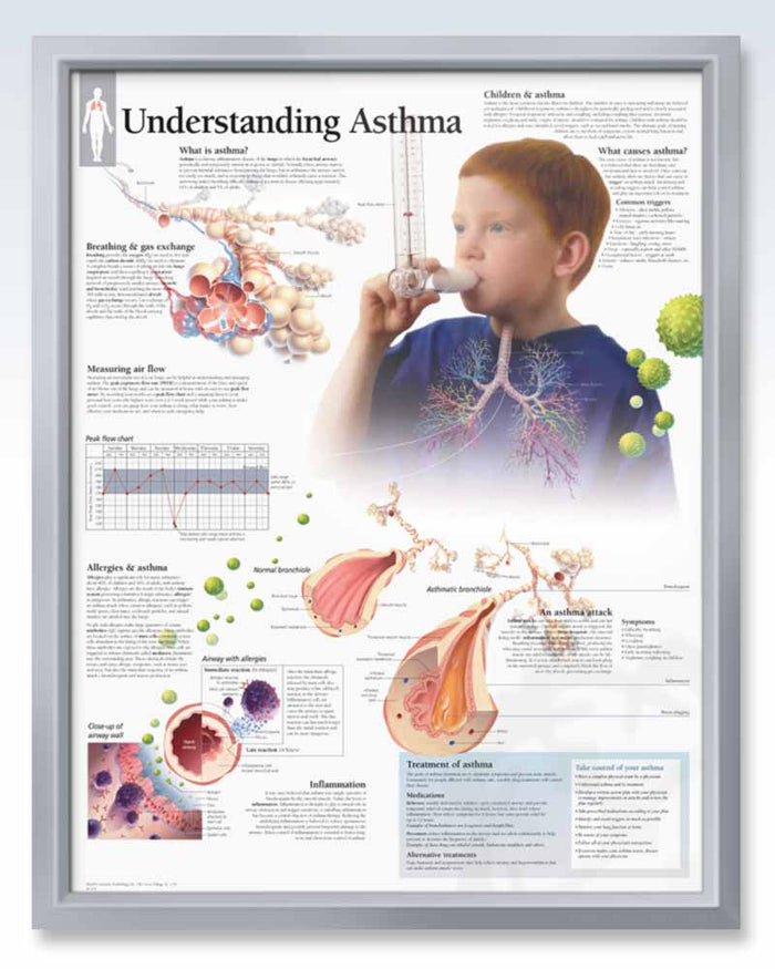 Understanding Asthma Exam-Room Anatomy Posters | ClinicalPosters