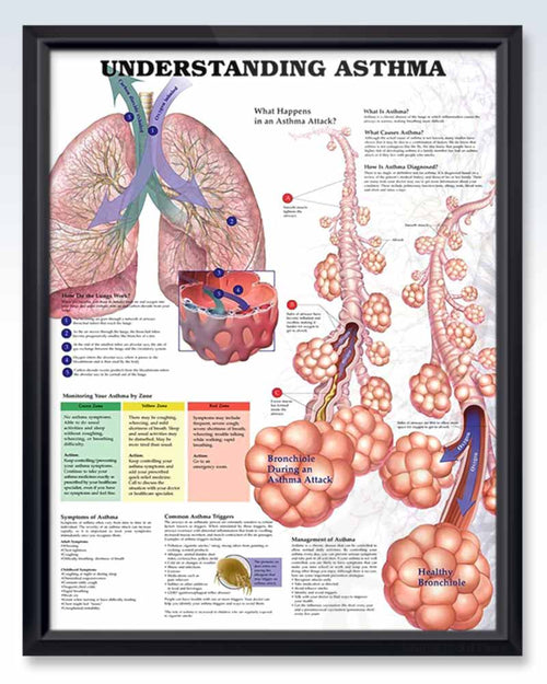 Respiratory Medical Anatomy Posters and Models – ClinicalPosters