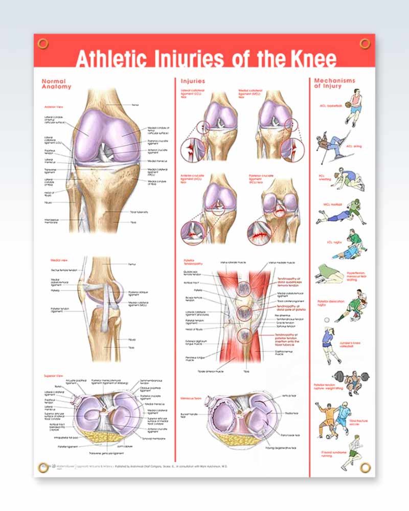 Laminated Athletic Knee Injuries Anatomy Poster | ClinicalPosters