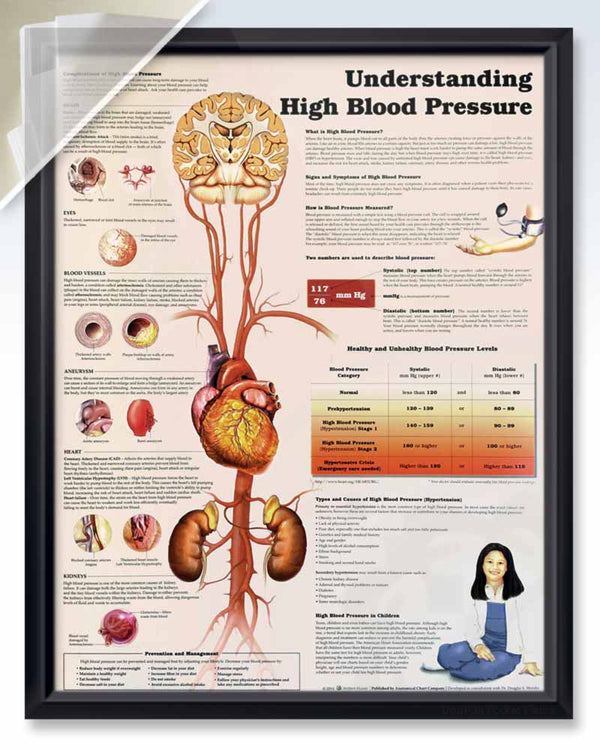 Understanding High Blood Pressure Discount Poster | ClinicalPosters