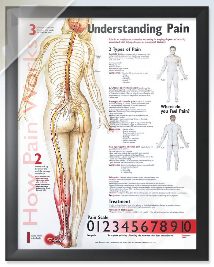 Understanding Pain Discount Poster | ClinicalPosters