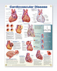 Cardiovascular Disease Exam Room Anatomy Posters | ClinicalPosters