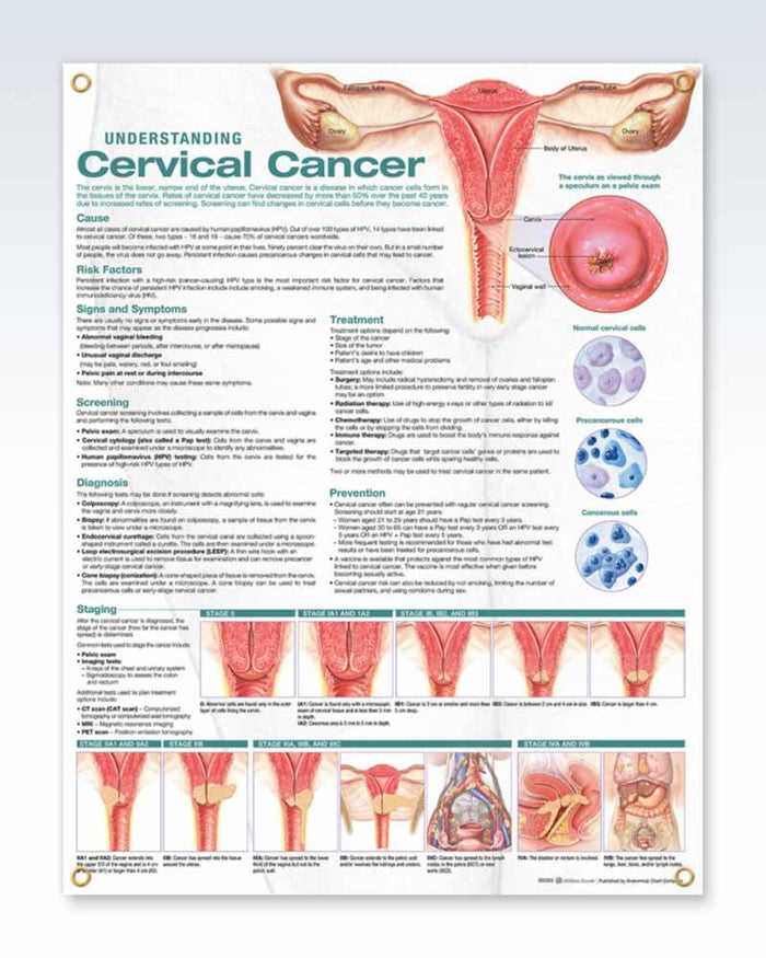 Laminated Cervical Cancer Anatomy Posters | ClinicalPosters