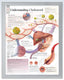Understanding Cholesterol Anatomy Poster | ClinicalPosters
