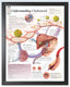 Understanding Cholesterol Anatomy Poster | ClinicalPosters