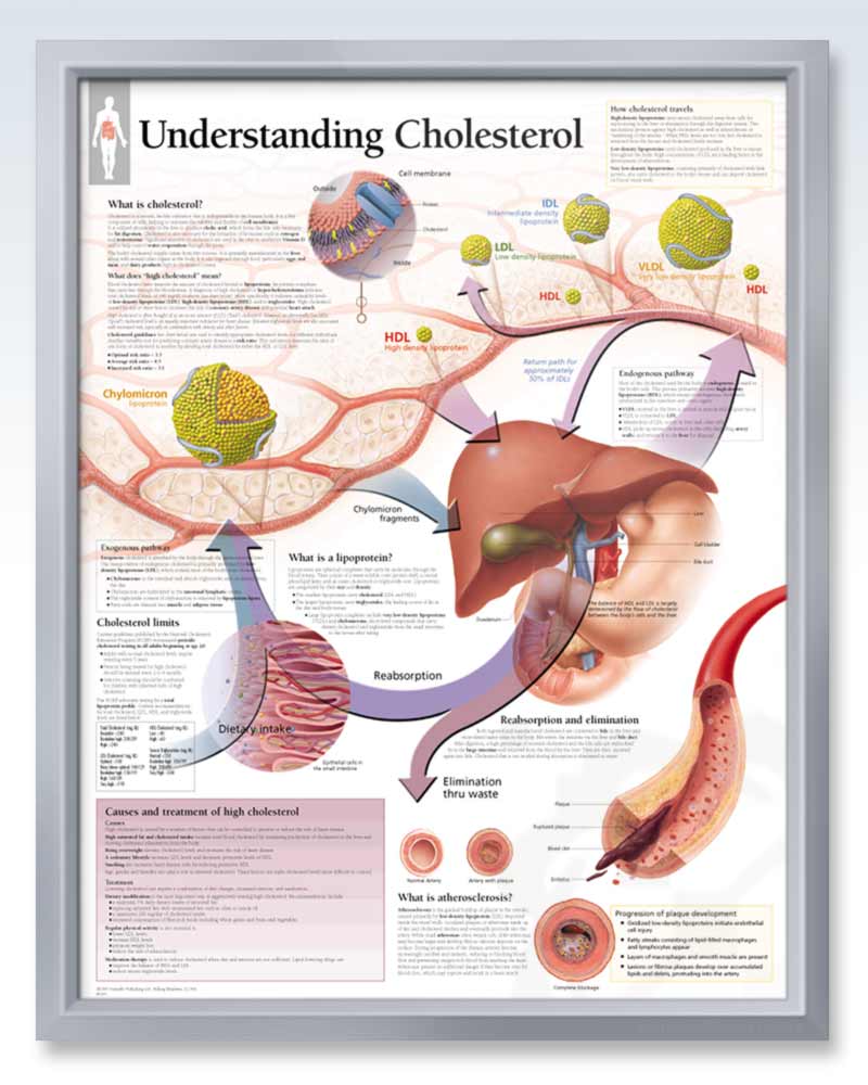 Understanding Cholesterol Anatomy Poster – clinicalposters.com