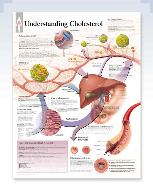 Understanding Cholesterol Anatomy Poster | ClinicalPosters