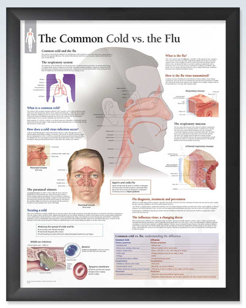Common Cold vs Flu Exam-Room Anatomy Posters | ClinicalPosters