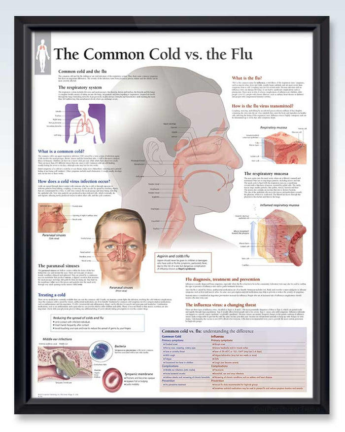 Common Cold vs Flu Exam-Room Anatomy Posters | ClinicalPosters
