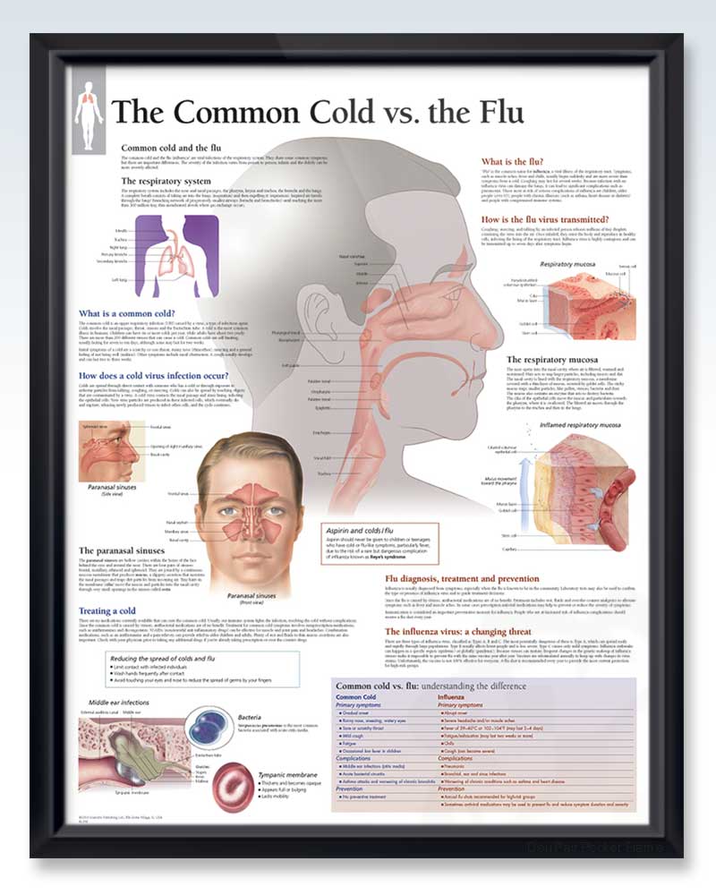 Common Cold vs Flu Exam-Room Anatomy Posters | ClinicalPosters