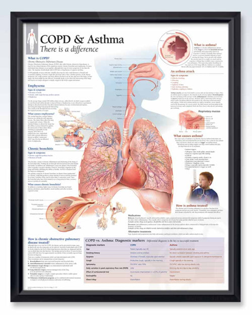 Respiratory Medical Anatomy Posters and Models – ClinicalPosters