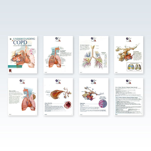 Understanding COPD Flip Chart 11x14 | ClinicalPosters