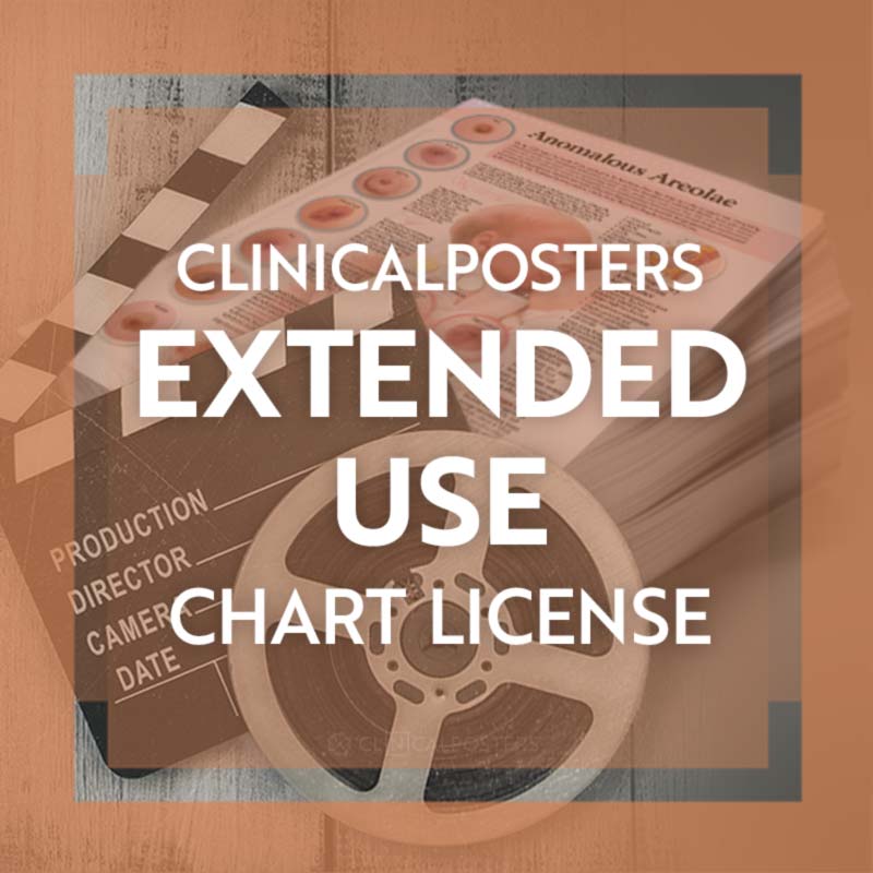 CP Motion Picture 20x26 Poster License Fee | ClinicalPosters