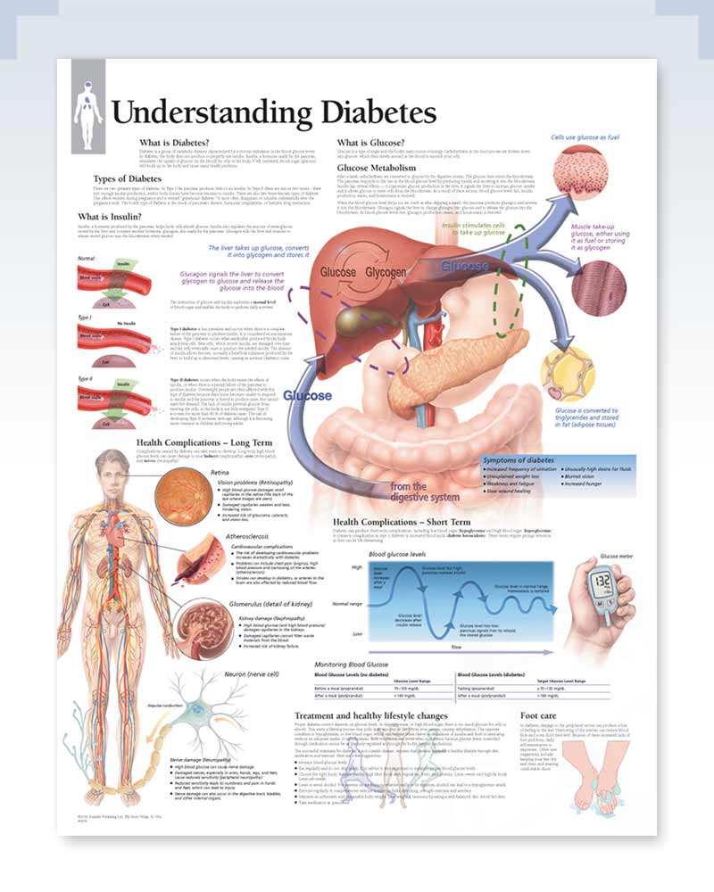 Understanding Diabetes Exam-Room Anatomy Poster | ClinicalPosters
