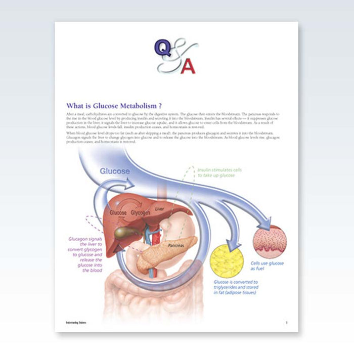 Understanding Diabetes Flip Chart 11x14 | ClinicalPosters