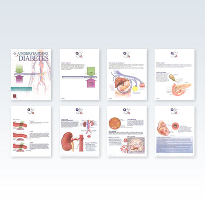 Understanding Diabetes Flip Chart 11x14 | ClinicalPosters