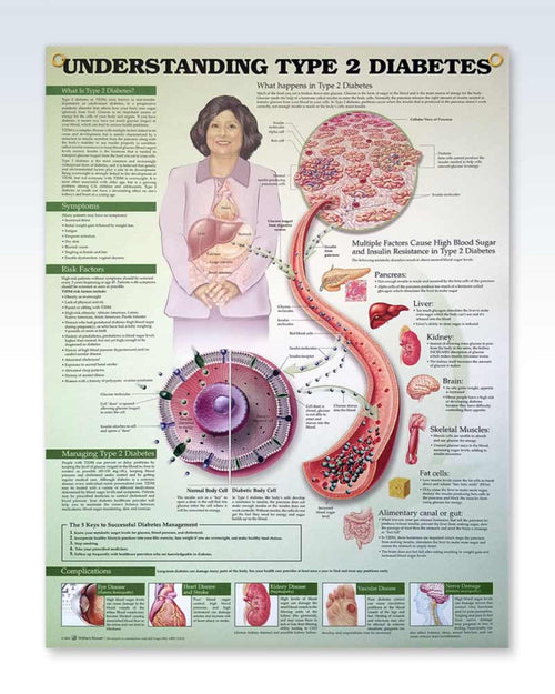 Laminated Type 2 Diabetes Anatomy Posters | ClinicalPosters