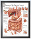 Digestive System Disease Anatomy Posters | ClinicalPosters