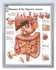 Digestive System Disease Anatomy Posters | ClinicalPosters