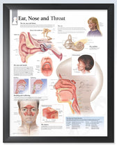 Ear, Nose and Throat Exam-Room Anatomy Poster | ClinicalPosters