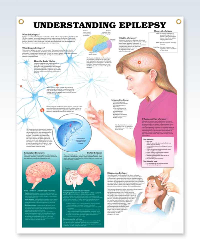 Laminated Epilepsy Human Anatomy Poster | ClinicalPosters