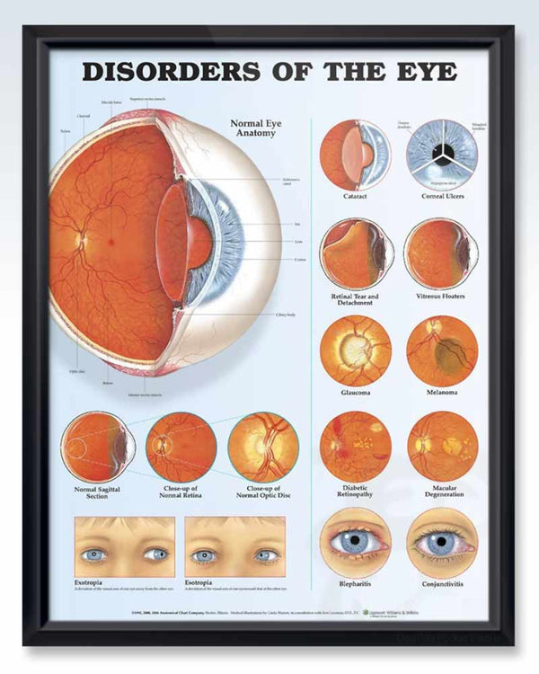 Disorders of the Eye Exam Room Anatomy Posters | ClinicalPosters
