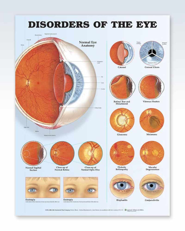 Disorders of the Eye Exam Room Anatomy Posters | ClinicalPosters