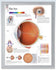 The Eye Exam-Room Human Anatomy Poster | ClinicalPosters