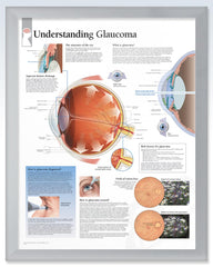 Understanding Glaucoma Exam-Room Anatomy Poster | ClinicalPosters